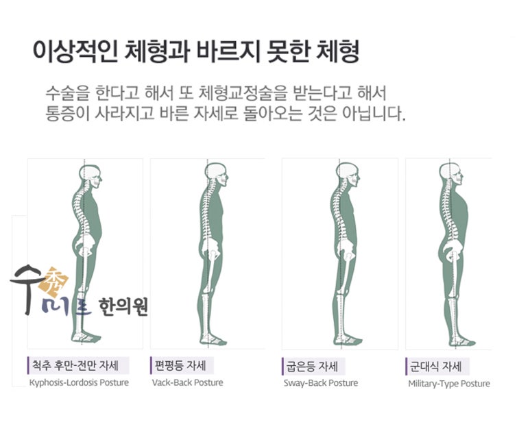 골반 틀어짐 원인 증상 하체라인으로 확인 네이버 블로그
