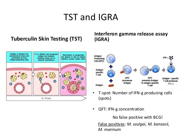 결핵검사 병원, 유학, 비자, 잠복결핵, IGRA, 결핵 스킨검사 : 네이버 블로그